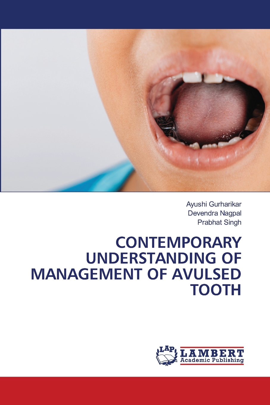 Buy CONTEMPORARY UNDERSTANDING OF MANAGEMENT OF AVULSED TOOTH