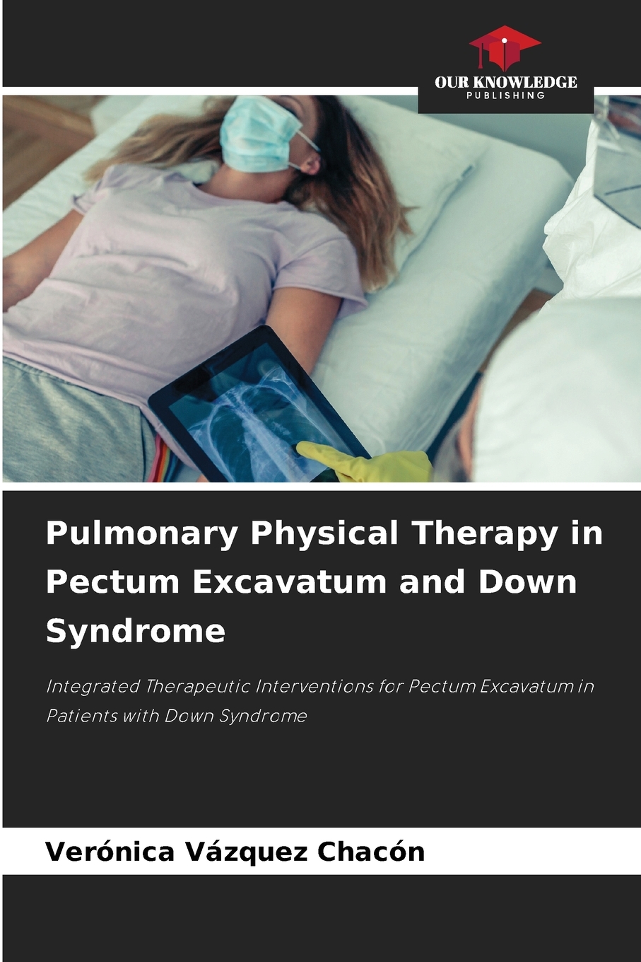 Buy Pulmonary Physical Therapy in Pectum Excavatum and Down Syndrome