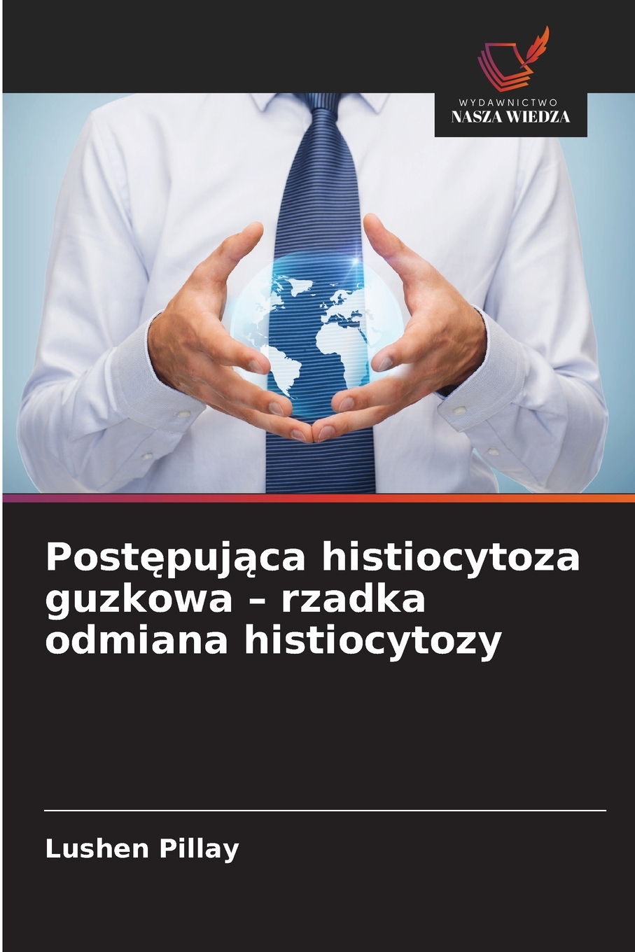Buy Postępująca histiocytoza guzkowa - rzadka odmiana histiocytozy Book ...